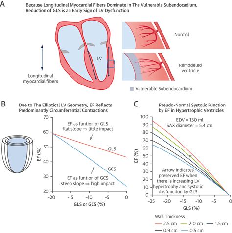 Myocardial Strain Imaging Theory Current Practice And The Future