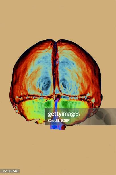 Two Brain Hemispheres Photos And Premium High Res Pictures Getty Images