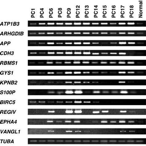 Confirmation Of Reliability Of The Microarray Data Expression Of 12