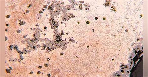 Casting Defects And Prevention Methods