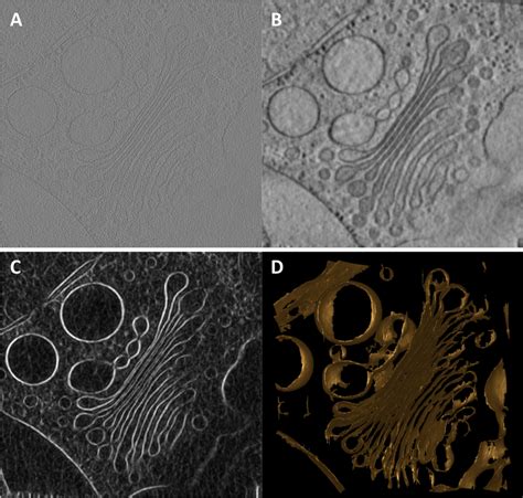 Application Of Membrane Segmentation Based On Hessian Tensor Local