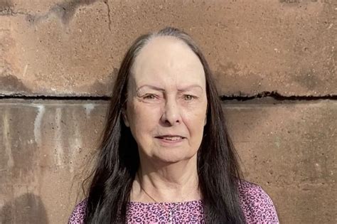 Balding Man Goes On Month Long Sex Ban For Hair Growth And Totally Transforms Daily Star