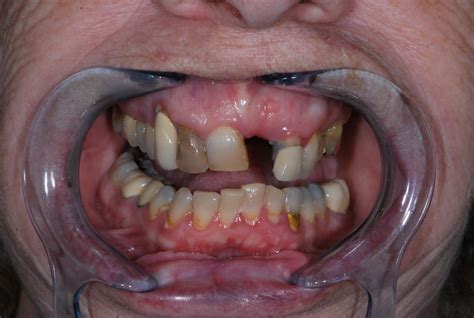 Village Oaks Dentistry Your Local Dentist Serving Martinez Pacheco