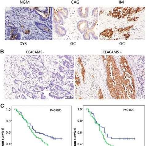Pdf Identification Of Ceacam5 As A Biomarker For Pre Warning And