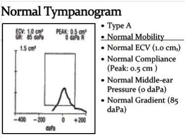 Practice Tympanograms Flashcards Quizlet