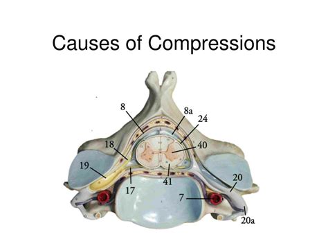 Ppt Spinal Cord Compression Powerpoint Presentation Free Download