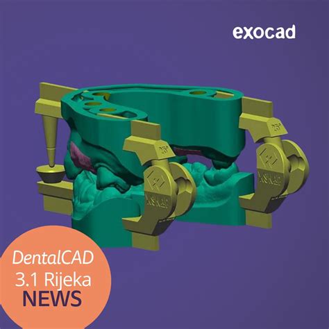 Exocad On Linkedin Exocad Digitaldentistry Xsnap Exocadexperts