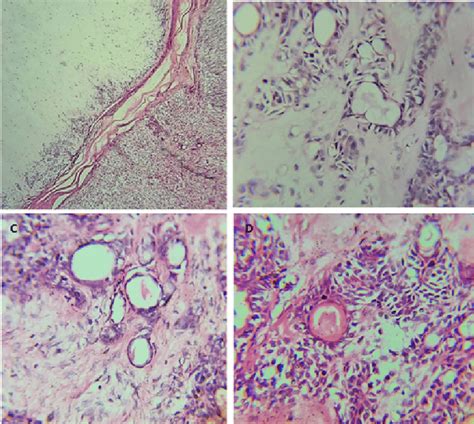 Histological Features Of The Mass Download Scientific Diagram
