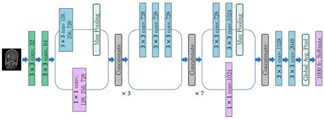 Electronics Free Full Text Classifying Brain Tumors On Magnetic Resonance Imaging By Using