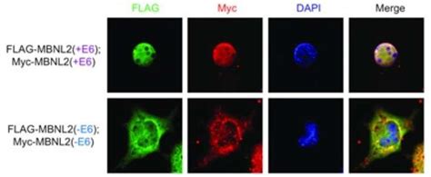 How To Compensate For Loss Of Gene Function Think Alternative Splicing