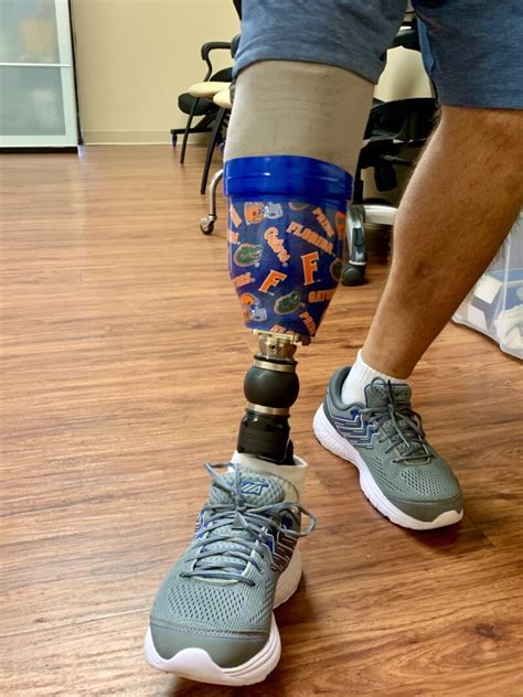 Prosthetic Leg Types Below The Knee Design Talk
