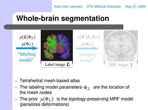 Ppt Generative Models For Automated Brain Mri Segmentation Powerpoint