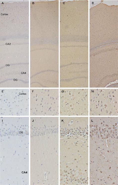 Immunohistochemical Staining Of Phosphorylated Tau Coronal Rat Brain