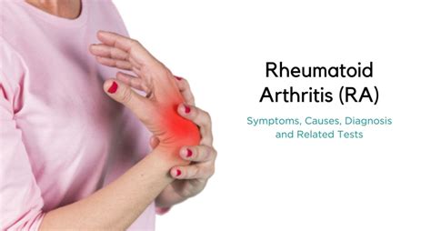 Rheumatoid Factor Ra Factor