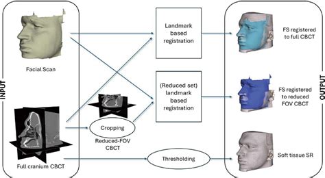 Figure 1 From Accuracy Of Facial Scan Registration A Comparison Between Full Cranium And