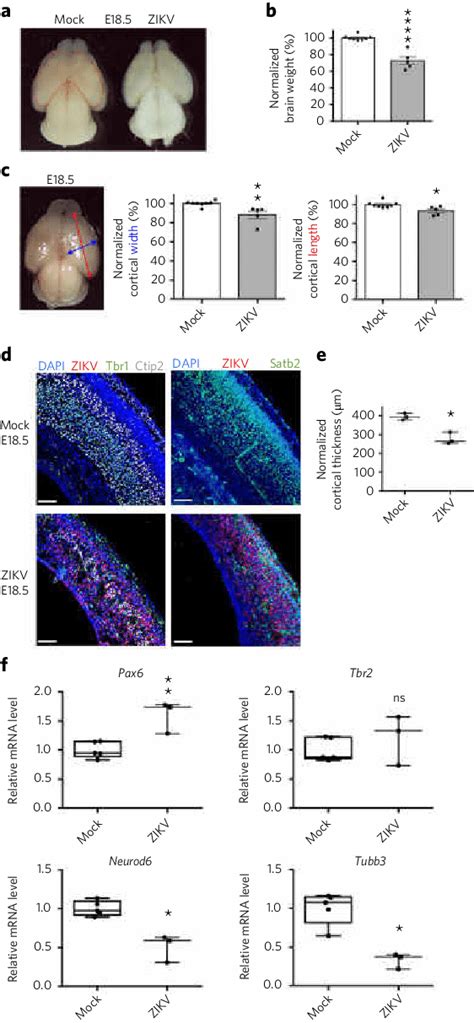 Icv Injection Of Zikv Induces Microcephaly In Mouse Embryos A E