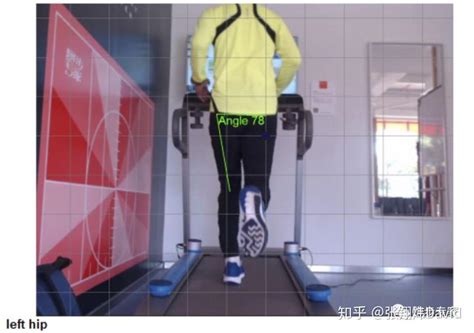 膝盖外侧疼痛怎么办？病因、解决方法 知乎