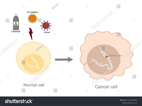 Picture Shows Risk Factor Uv Radiation Stock Vector Royalty Free