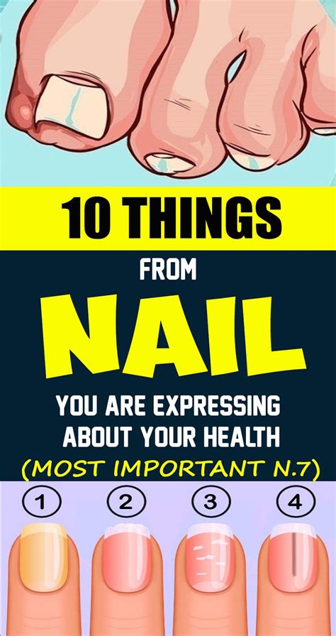 Here Are 10 Things Your Nails Can Reveal About Your Health Healthmgz