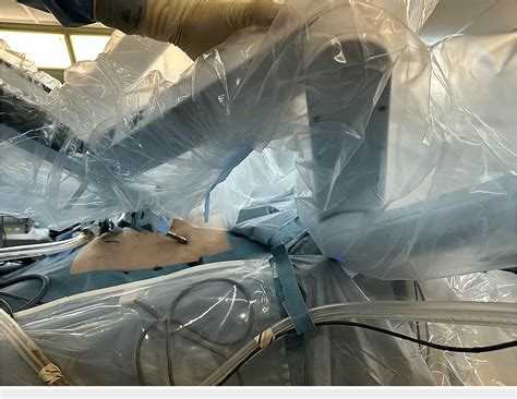 Posterior Interosseous Nerve