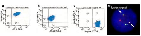 Cooccurrence Of Cd10 Positive And Cd10 Negative Mantle Cell Lymphoma