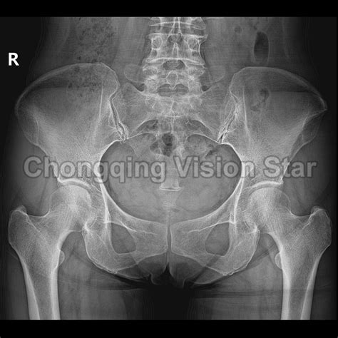 Xur50kw Dr U Arm Digital Radiography System China Manufacturer Price