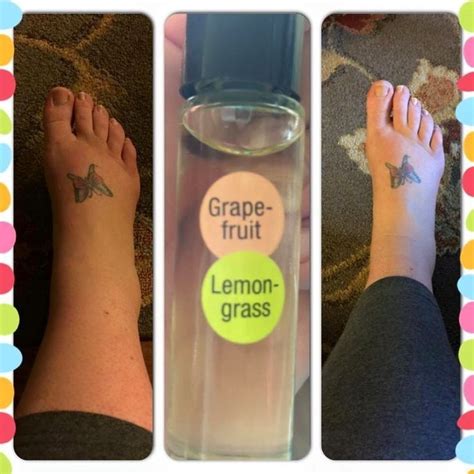 How To Use Essential Oils To Treat Swollen Ankles Feet Artofit