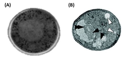 Transmission Electron Micrographs Of C Albicans A Control Cell B
