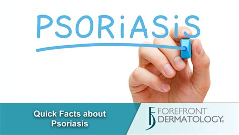 Quick Facts About Psoriasis Forefront Dermatology