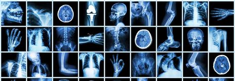 Differences Between RIS CIS PACS And DICOM HighQualityBlog