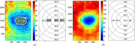 User Guided Segmentation For Volumetric Retinal Optical Coherence Tomography Images