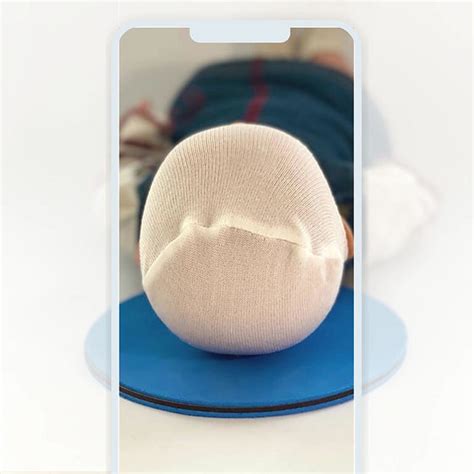 Skull Deformation Measurement Skully Care