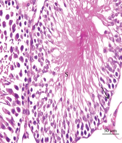 Photomicrographs Of Sections In Testis Of Control Rat Groups A