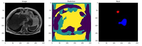 Radiology Machine Learning Multi Image Segmentation With Transunet