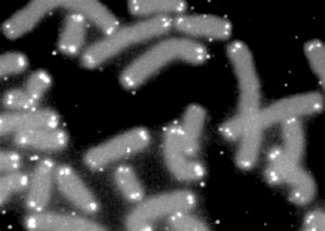 Quick Take Risk Of Appendiceal Neoplasm In Periappendicular Abscess In