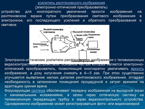 Рентгеновские аппараты - online presentation