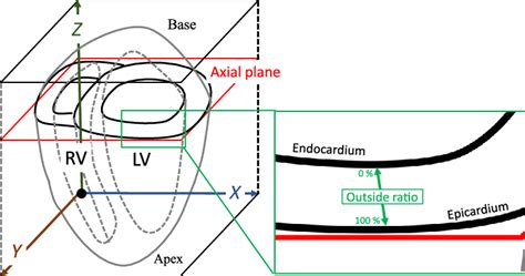 Coordinate System And Position Of Ventricles Axial Planes X − Y Download Scientific Diagram