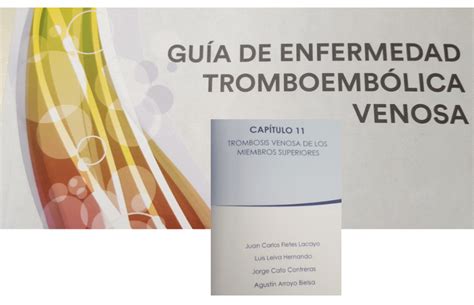 Ya Está Editada La Guía De Enfermedad Tromboembólica Venosa Clínica