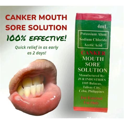 Canker Mouth Sore Solution Gamut Sa Singaw Lazada Ph