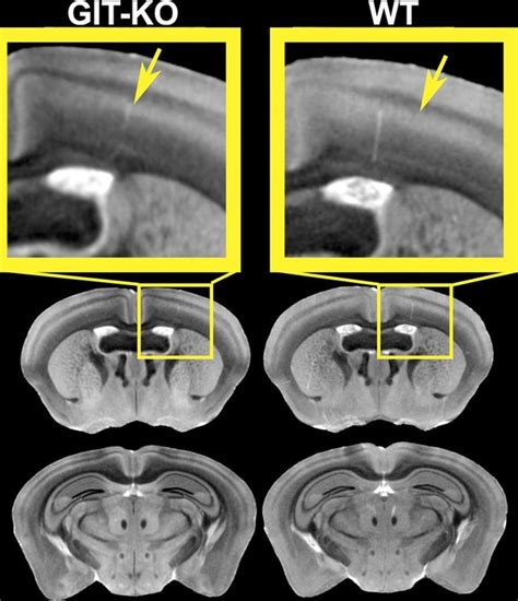 Microcephaly With Altered Cortical Layering In Git1 Deficiency Revealed By Quantitative