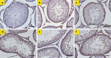 Immunohistochemical Staining Of Pk2 In Rat Testes Control Testis