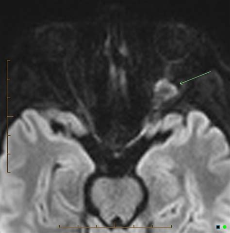 Image Radiopaedia Org