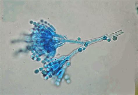 Atlas Micologia Penicillium Chrysogenum