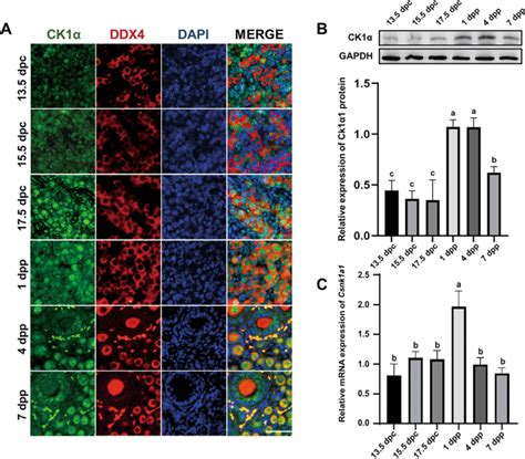 卵母细胞酪蛋白激酶 1α 缺失通过损害卵母细胞减数分裂和增强小鼠卵巢发育中的自噬导致原始卵泡形成缺陷和卵母细胞丢失cell Death Discovery X Mol