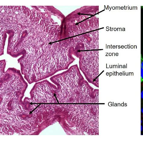 Pdf The Elusive Endometrial Epithelial Stemprogenitor Cells