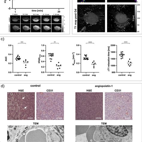 Analysis Of Vessel Stabilizing Angiopoietin 1 Treatment A Exemplary