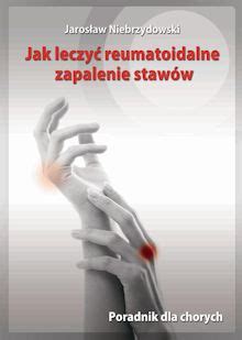 Jak leczyć reumatoidalne zapalenie stawów Jarosław Niebrzydowski Recenzje książek z każdej półki