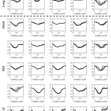 Circumferentiallongitudinal Strain Averaged Over Each Imaging Plane