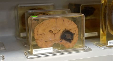 Pathology Museum Nus Pathology