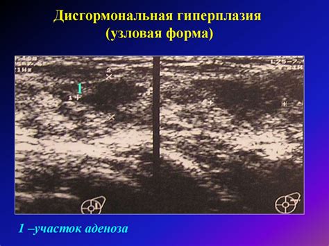 Ультразвуковое исследование поверхностно расположенных органов и